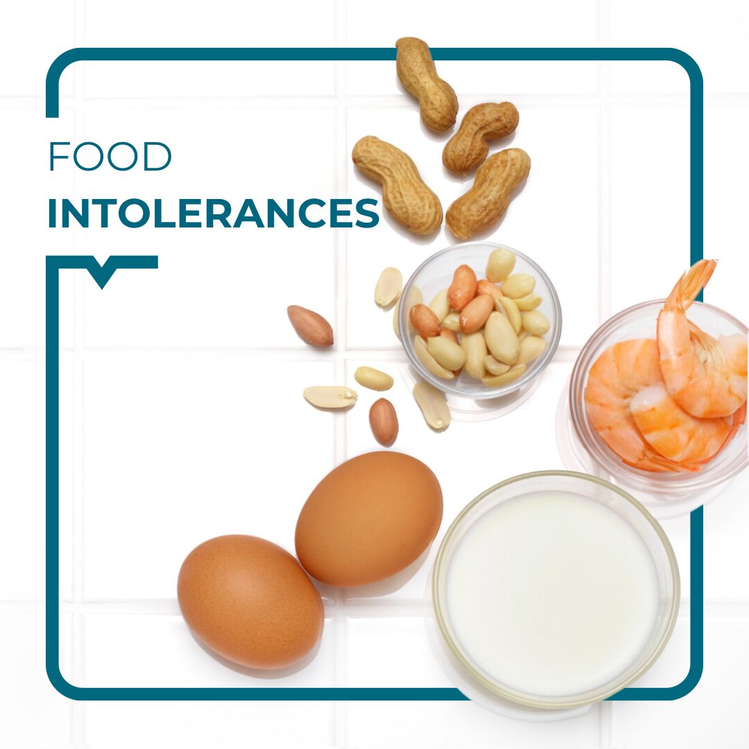 Food intolerances - Alegria Medical Centre