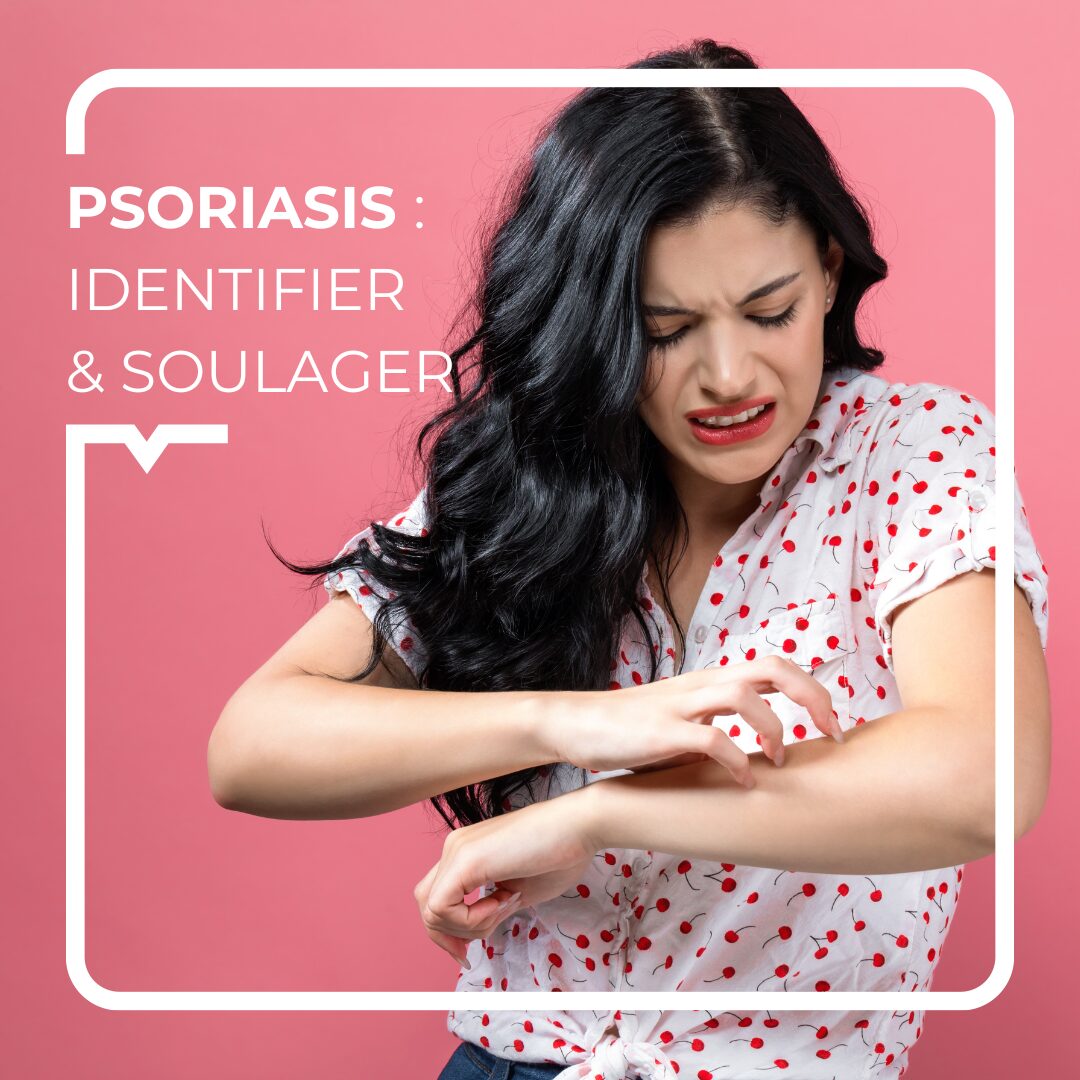 Le psoriasis : l'identifier et le soulager - Alegria Medical Centre