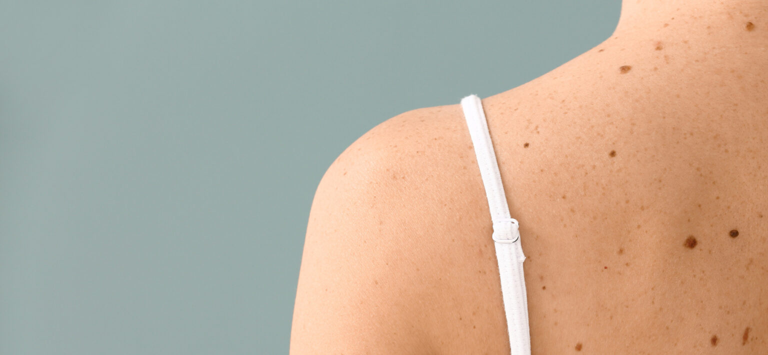 What you need to know about skin examination - Alegria Medical Centre