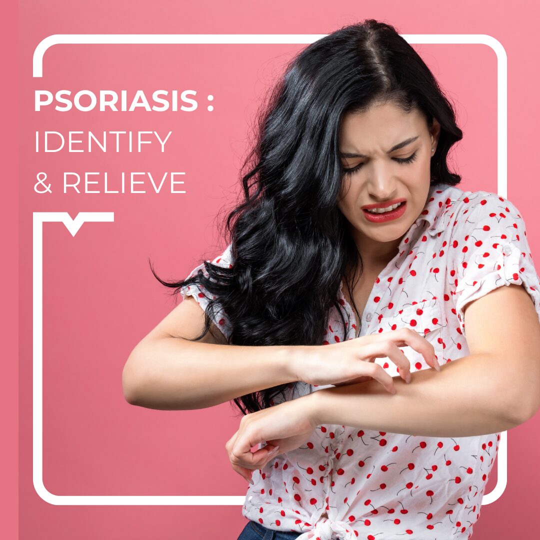 Psoriasis: identifying and relieving it - Alegria Medical Centre