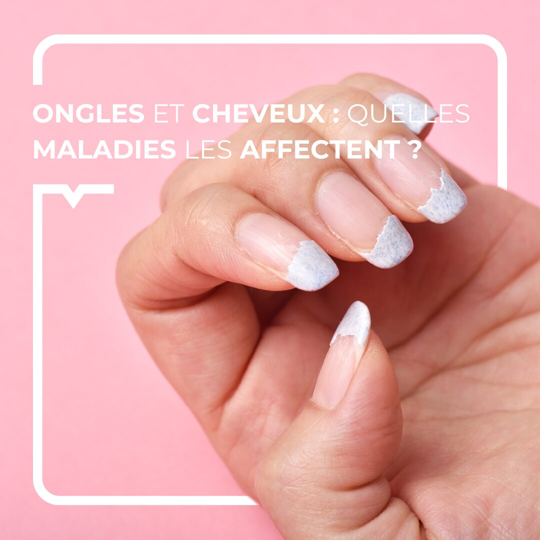 Ongles et cheveux : quelles maladies les affectent ? - Alegria Medical Centre