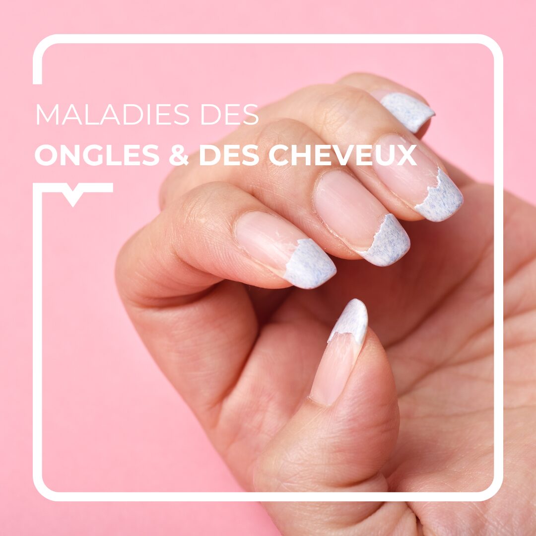 Ongles et cheveux : quelles maladies les affectent ? - Alegria Medical Centre