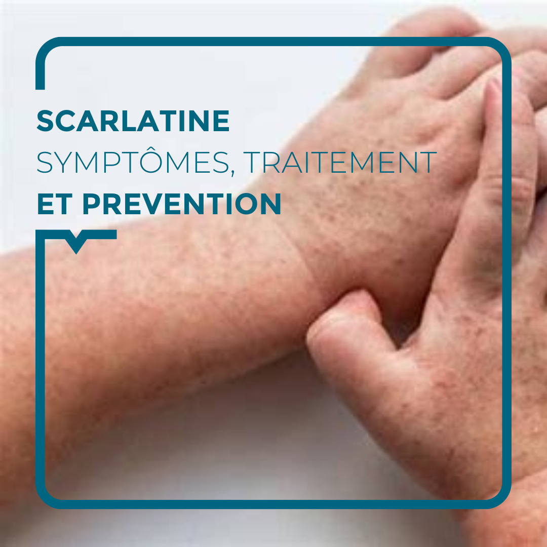 La scarlatine - Alegria Medical Centre