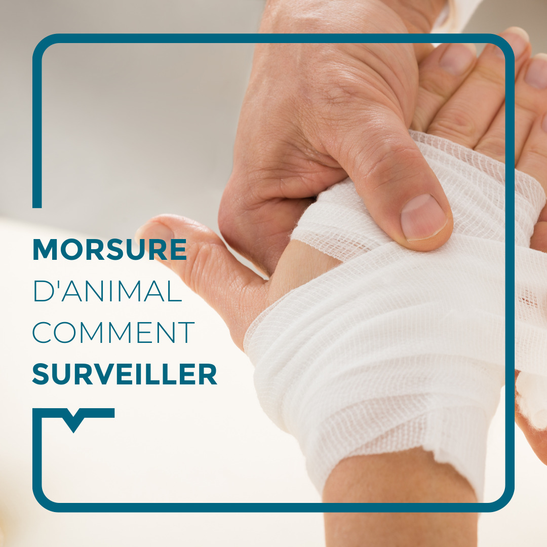 Agir face à une morsure d’animal - Alegria Medical Centre