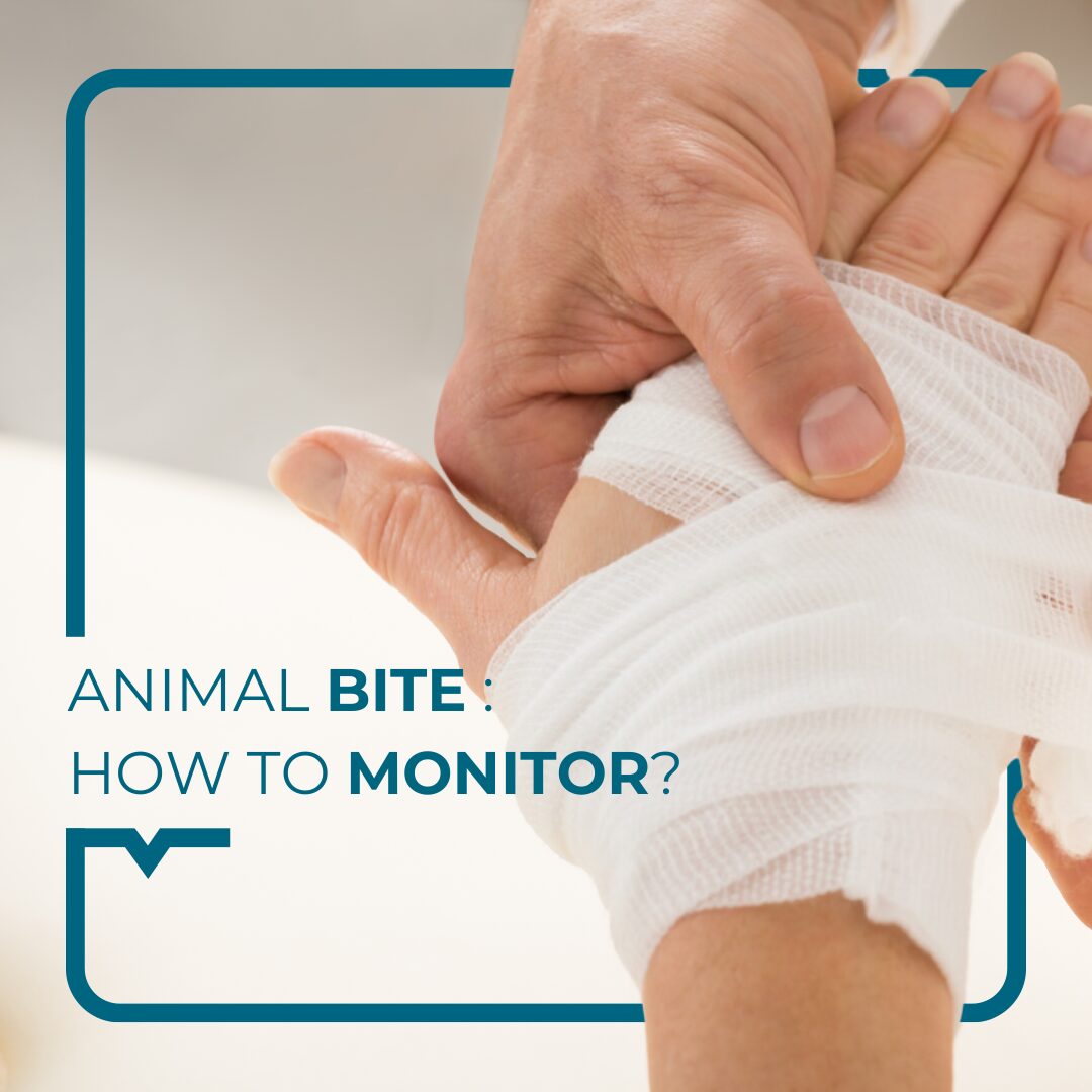 Animal bite, how to deal with it ? - Alegria Medical Centre