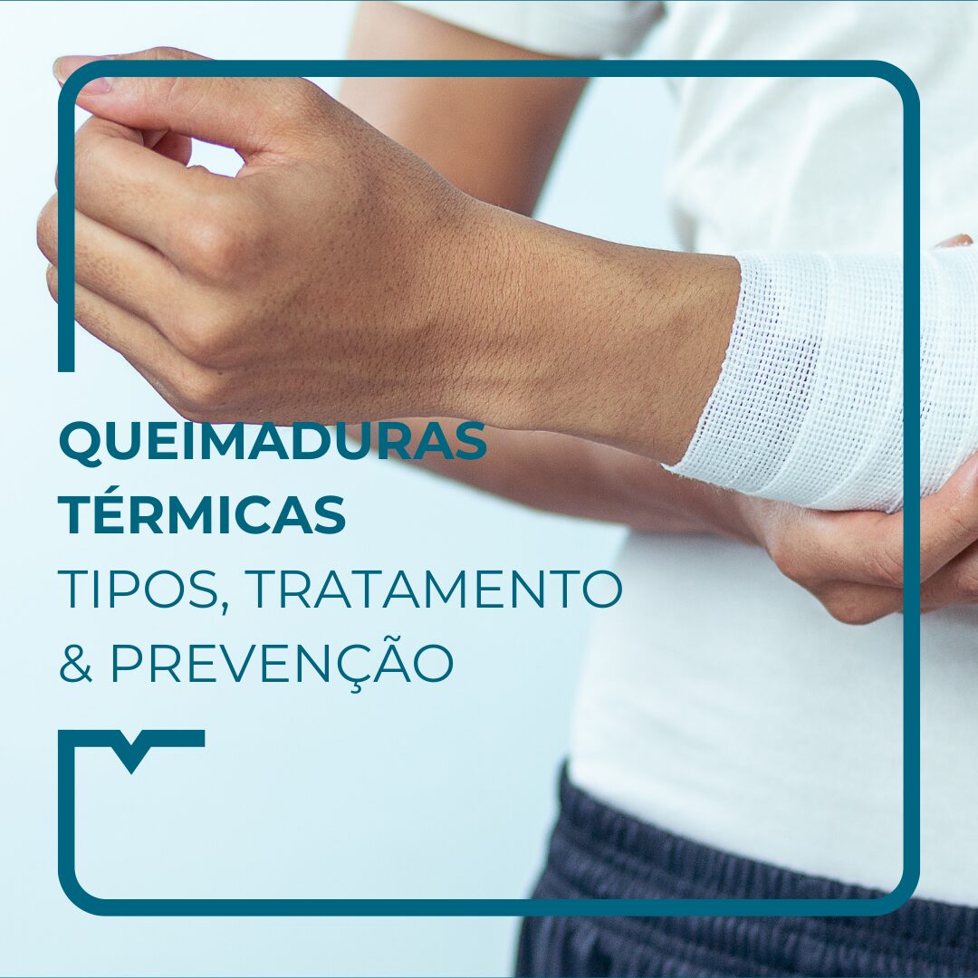 Queimaduras térmicas : Tipos, tratamento e prevenção - Alegria Medical ...