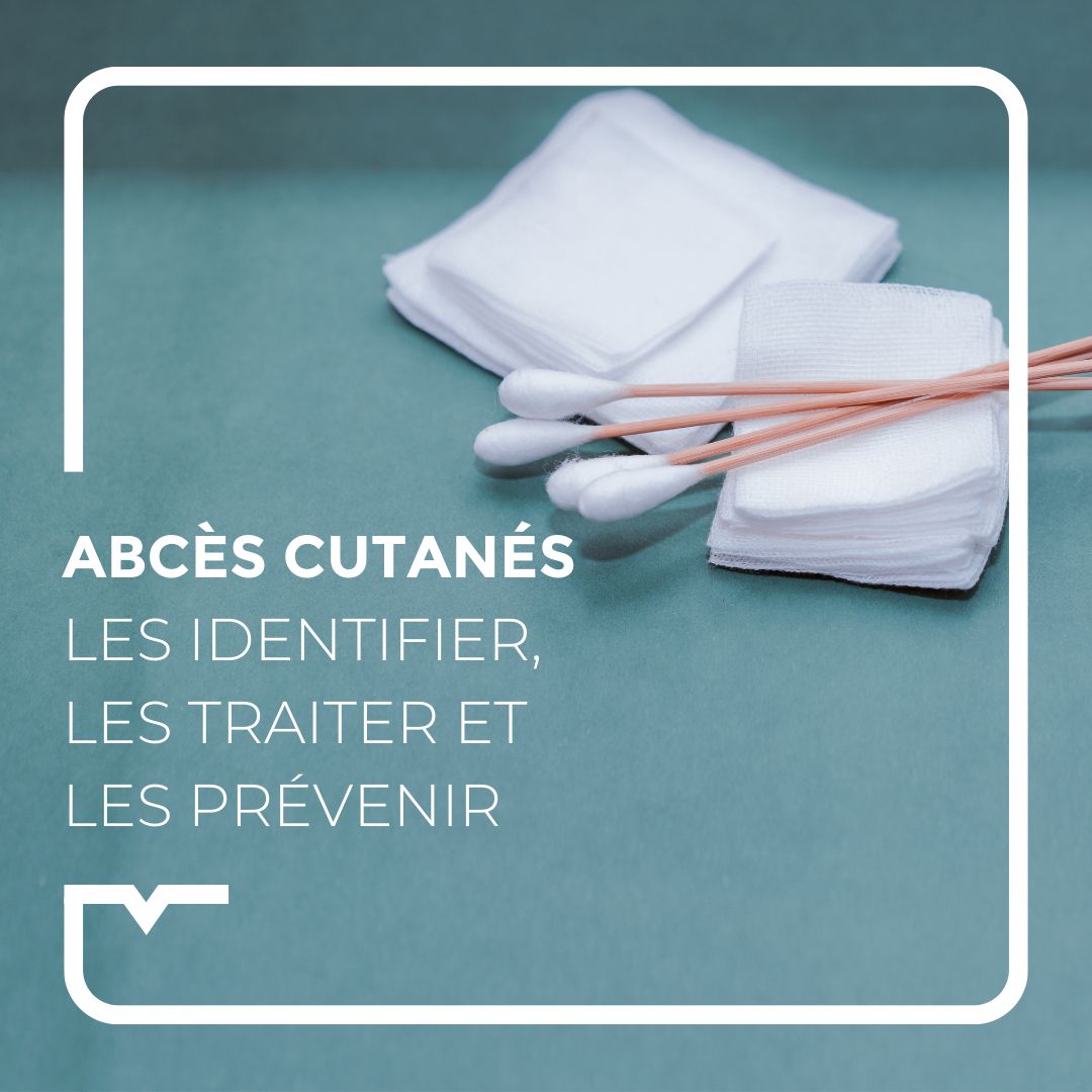 Abcès cutanés : Les identifier, les traiter et les prévenir - Alegria ...