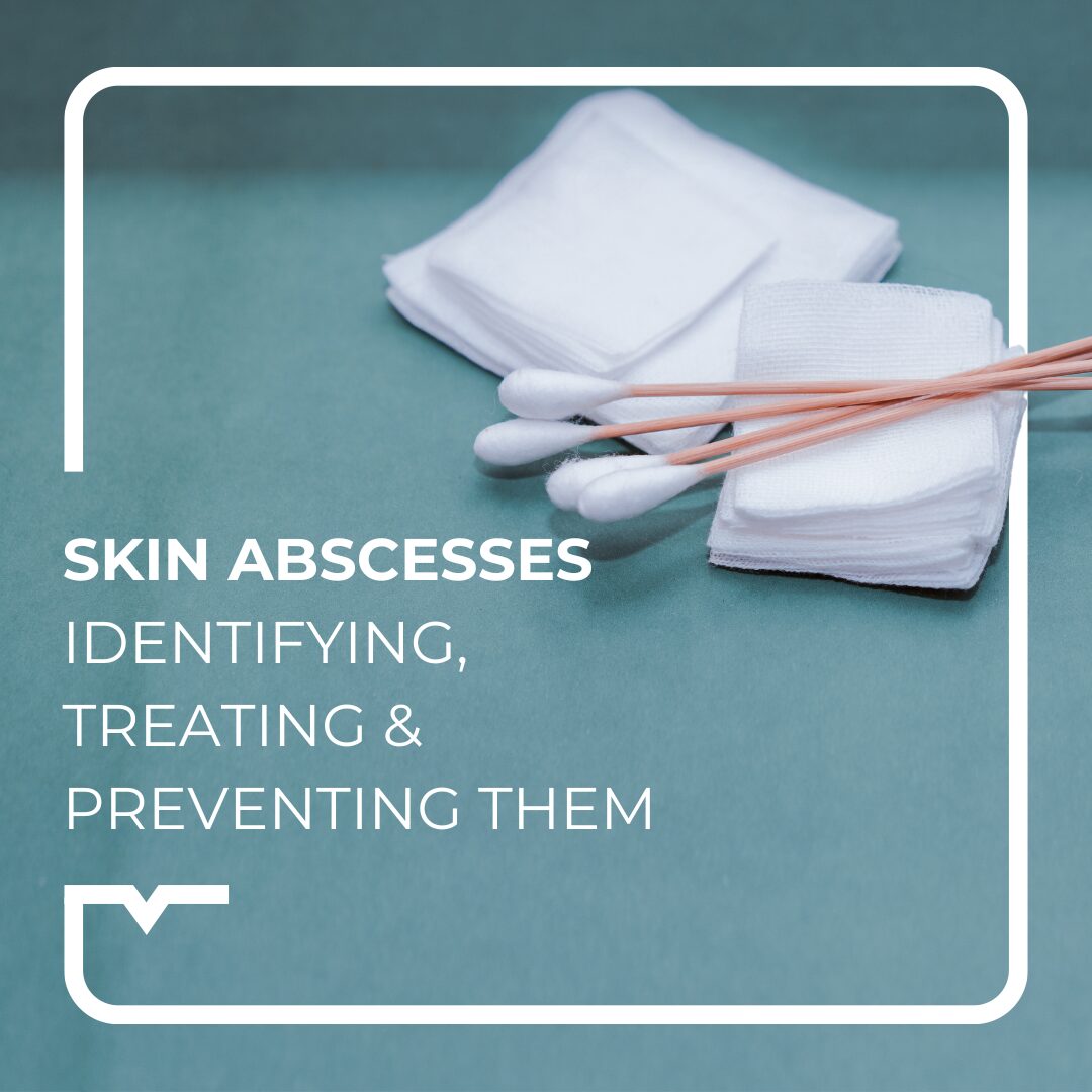 Skin abscess: identifying, treating and preventing them - Alegria ...