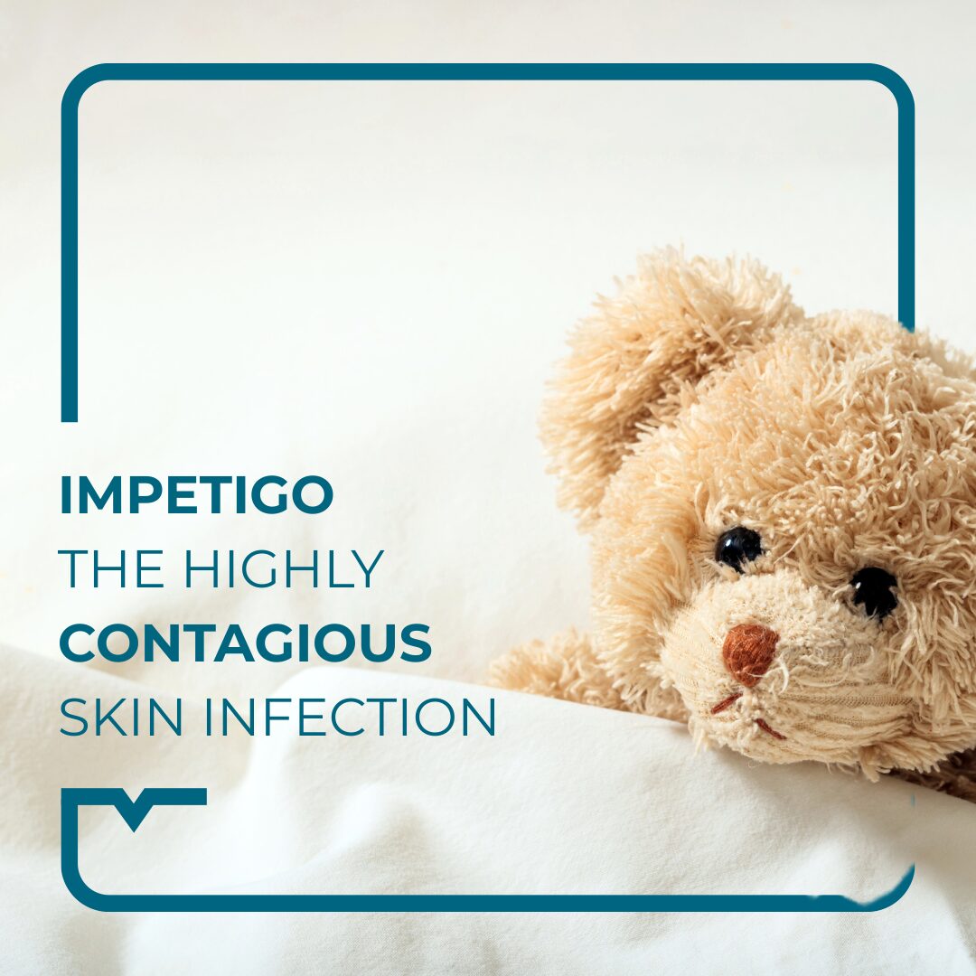 Impetigo: The highly contagious skin infection - Alegria Medical Centre