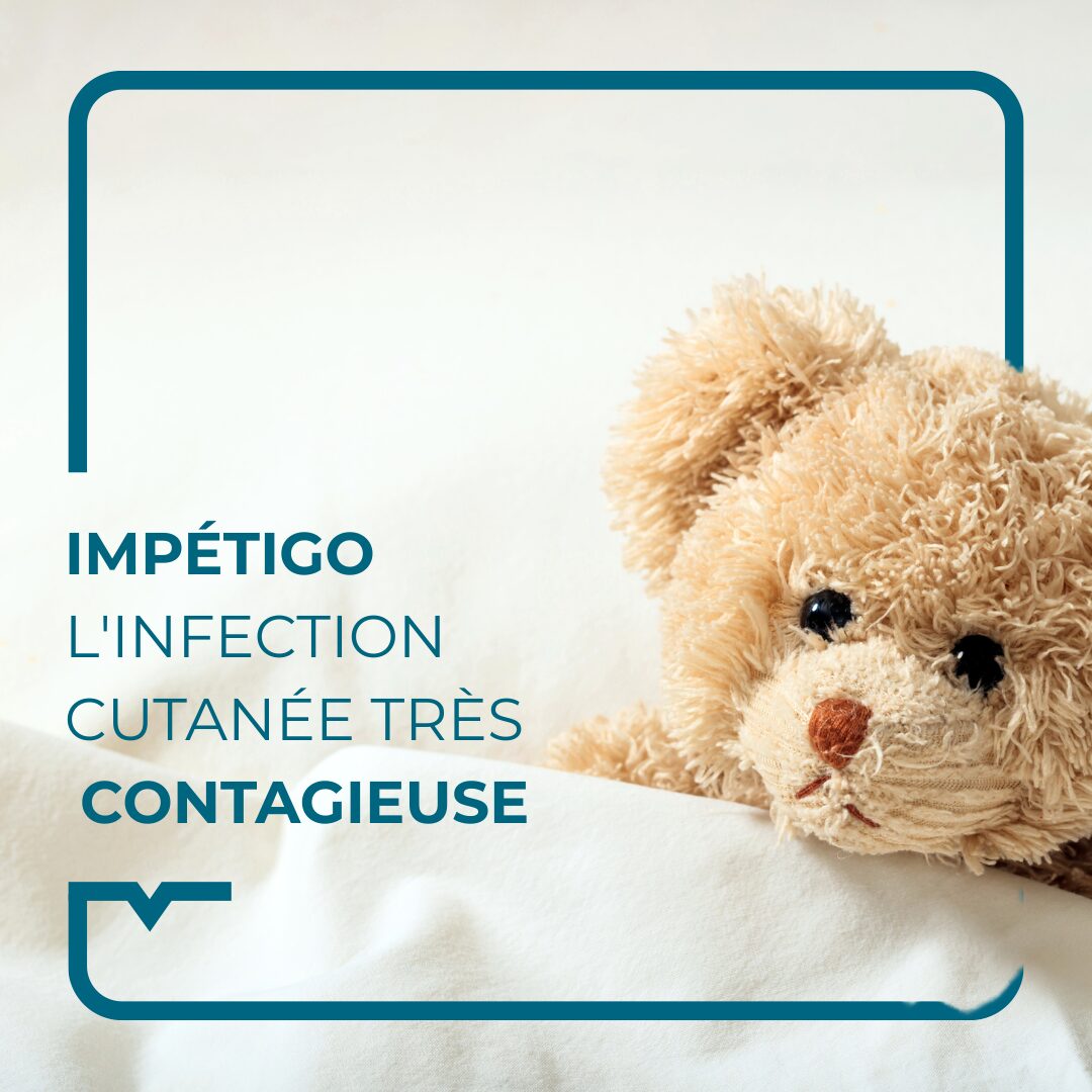 Impétigo: L'infection cutanée très contagieuse - Alegria Medical Centre