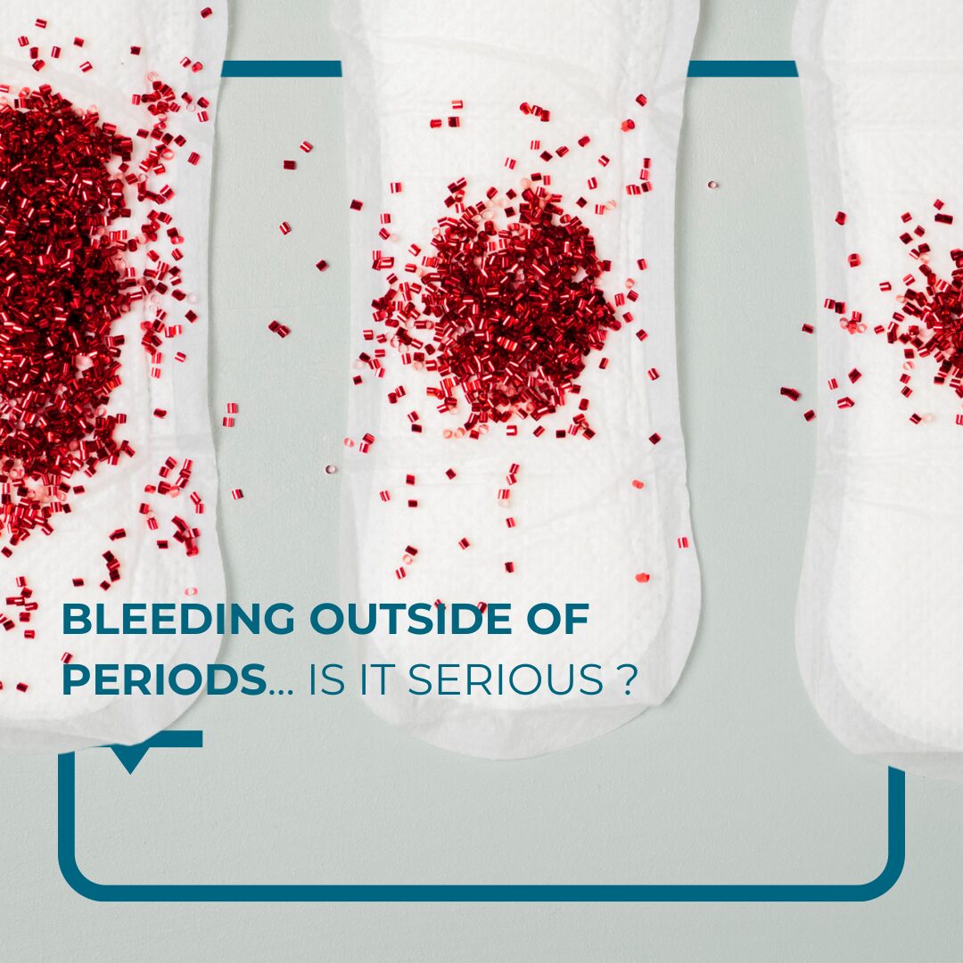 Bleeding outside of periods... Is it serious ? - Alegria Medical Centre