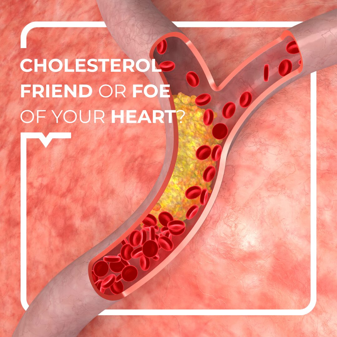 Cholesterol: Friend or foe of your heart? - Alegria Medical Centre